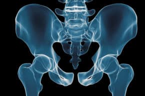 Stryker Hip Replacement Lawsuit - ABG II & Rejuvenate